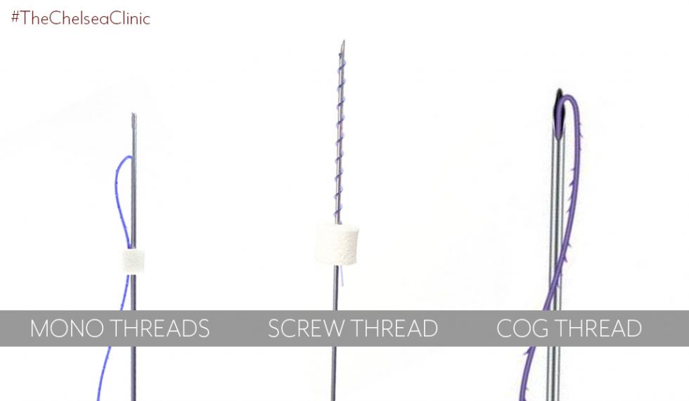 Facial Features - The Chelsea Clinic