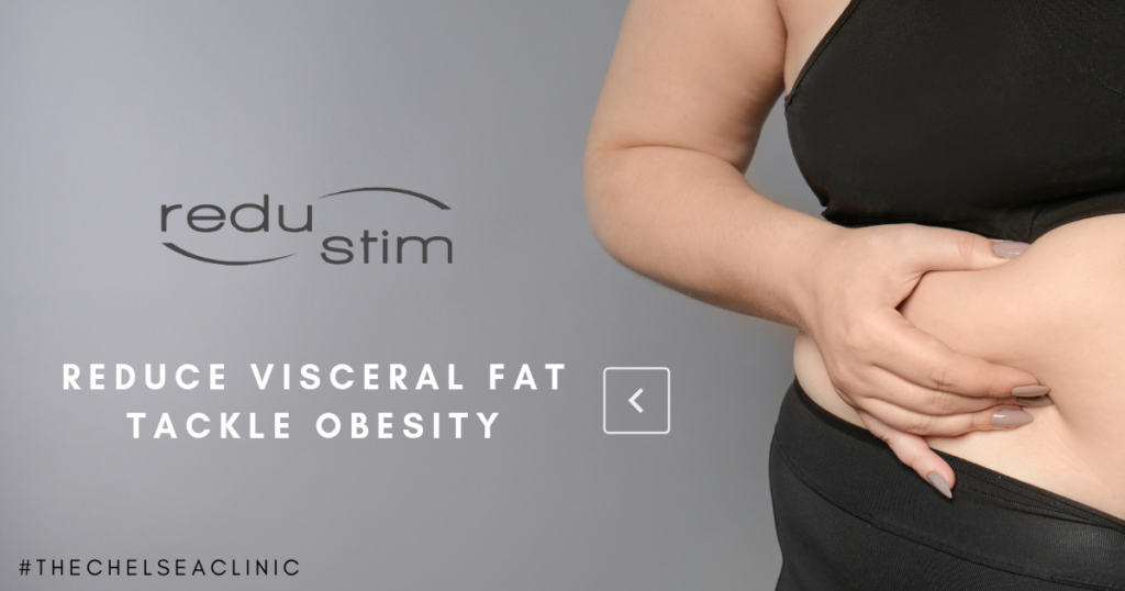 Excess Fat - The Chelsea Clinic